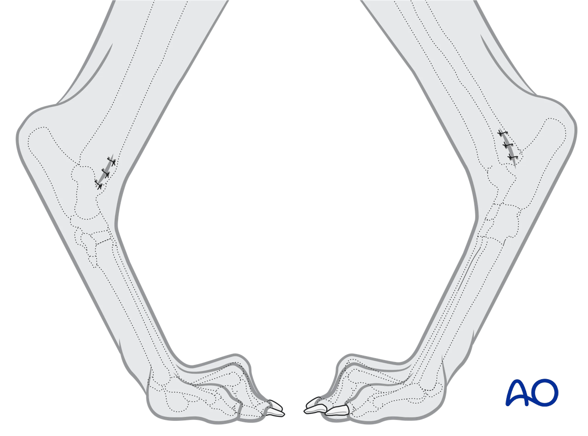 Minimally invasive approach to the dog distal tibia