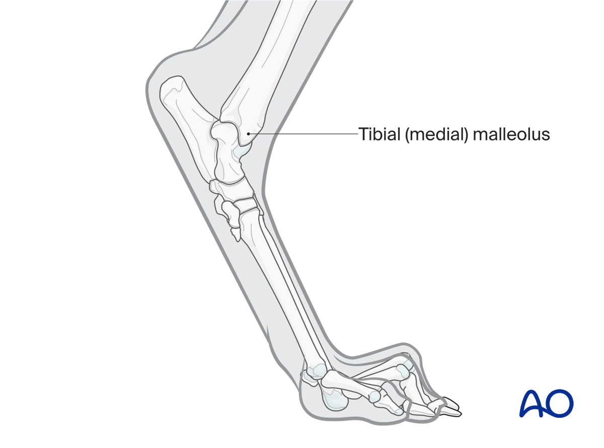 Medial approach to the dog distal tibia