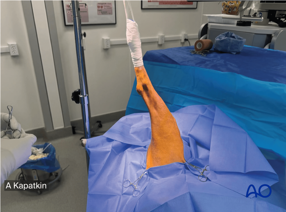 Lateral recumbency position